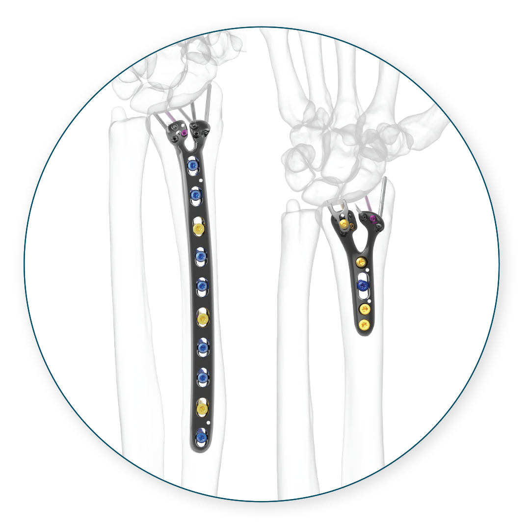 About – Orthospec SA